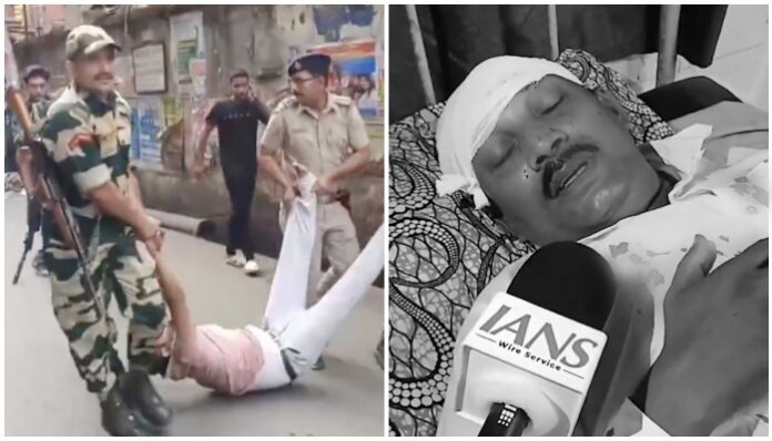 West Bengal polls: BJP polling agent Mosharef brutally attacked by TMC ...